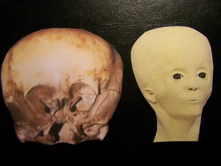 The Starchild Skull – Mexico Unexplained